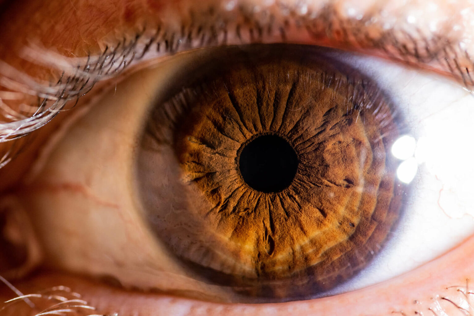 Corneal Transplant Surgery | Lakeland Eye Clinic